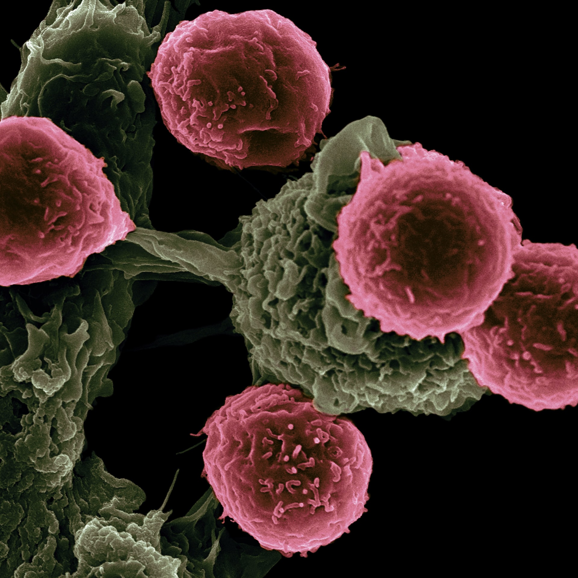 Analysis of Tumor-Derived Exosomes by Nanoscale Flow Cytometry - LabNalCit